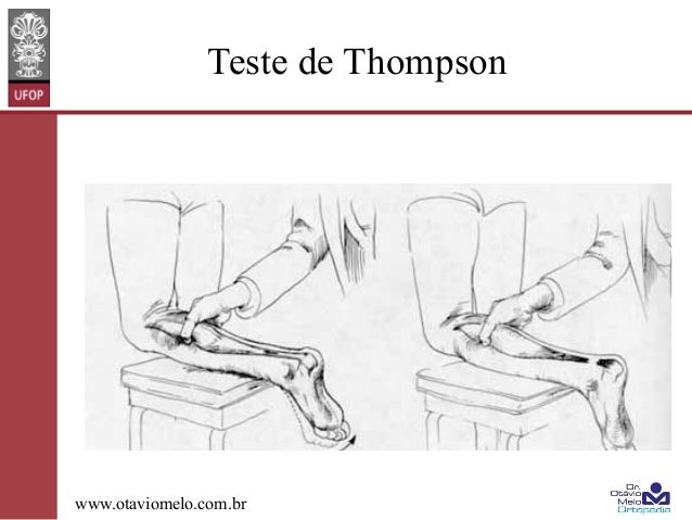 Semiologia ortopédica tjmg