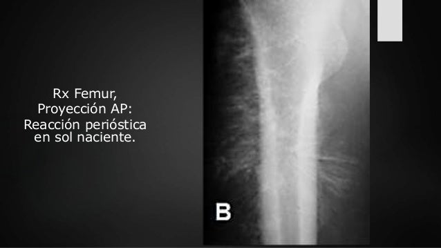 Semiologia osea radiologica