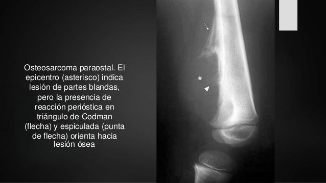 Semiologia osea radiologica