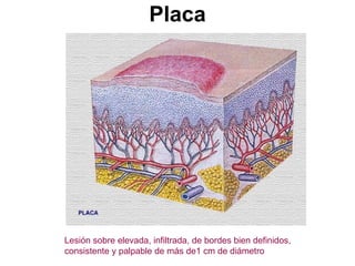 Semiologia Patologia Piel Unal | PPT