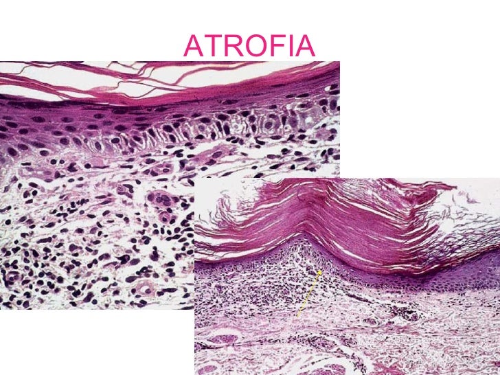 Semiologia Patologia Piel Unal