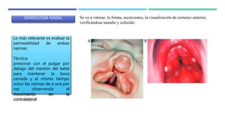 Semiología pediátrica Enfermería | PPTX