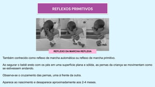 SEMIOLOGIA PEDIÁTRICA NEUROLÓGICA - Reflexos | PDF