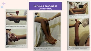 SEMIOLOGIA PEDIÁTRICA NEUROLÓGICA - Reflexos | PDF