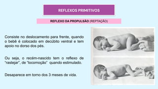 SEMIOLOGIA PEDIÁTRICA NEUROLÓGICA - Reflexos | PDF