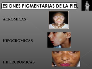 Semiologia de la piel | PPT