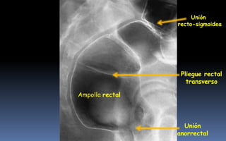 Semiologia radiologica de abdomen | PPTX
