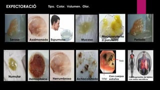 semiologia_respiratoria, definición, maniobras | PPTX