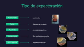 semiologia respiratoria pediátrica (1).pptx