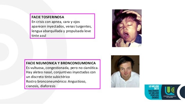 Semiologia respiratorio