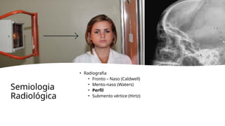 semiologia radiologica seios da face.pptx