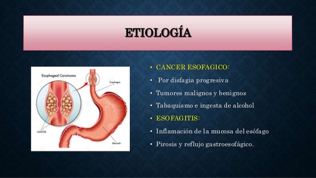 Semiologia sindrome esofagico, ulceroso y gastritis