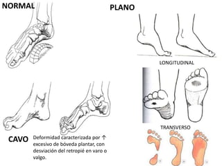 Semiologia tobilllo y pie | PPTX