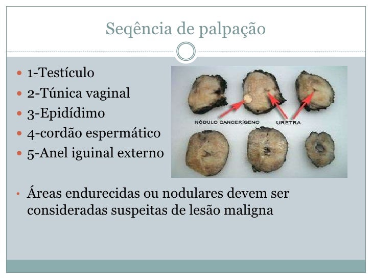 Semiologia urológica