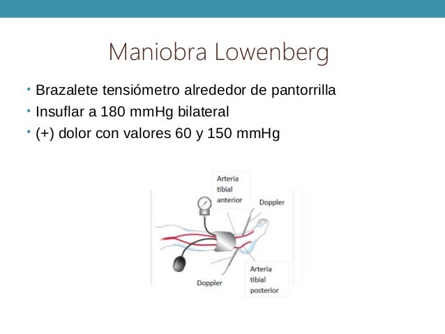 Semiologia vascular y pruebas diagnosticas