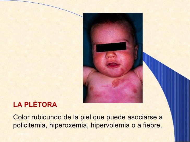 Atención inmediata del recién nacido