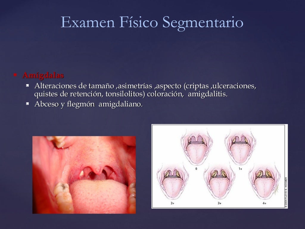 Semiologia de orofaringe