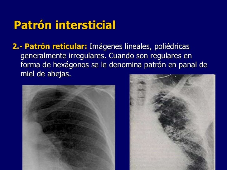 Semiologia respiratoria 1