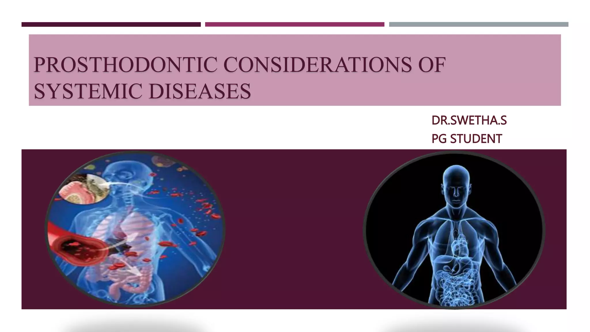 PROSTHODONTIC CONSIDERATIONS OF SYSTEMIC DISEASES | PPTX
