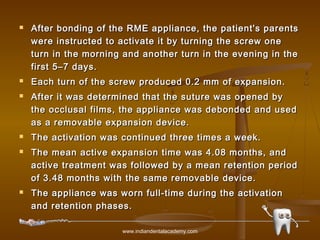 Semirapid maxillary expansion | PPT