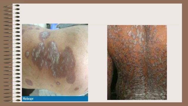 Semisolid_Dosage_Forms_SCU_2016.pptx