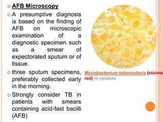 tuberulosis ppt | PPTX