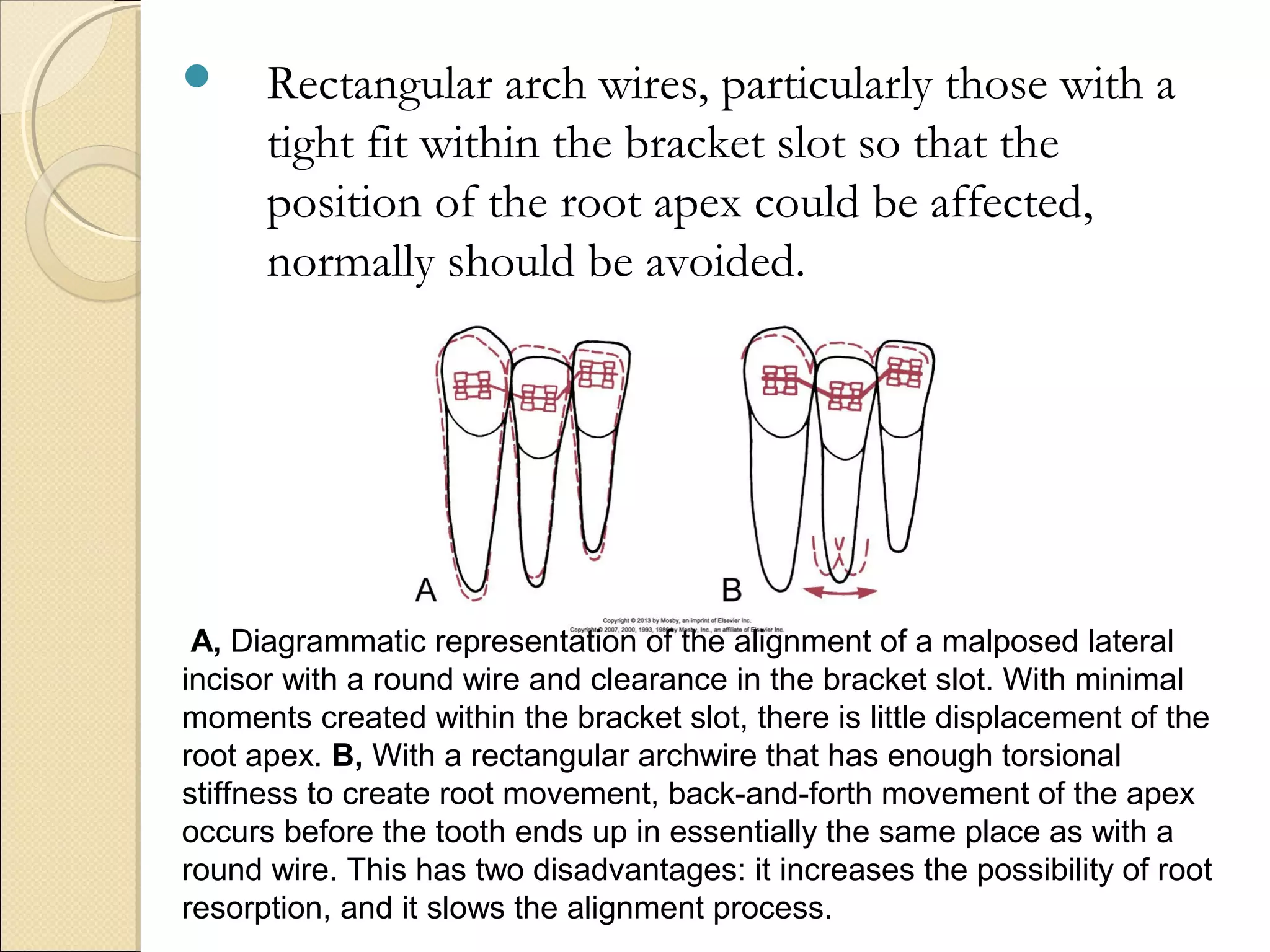 leveling and aligning in orthodontics | PPT