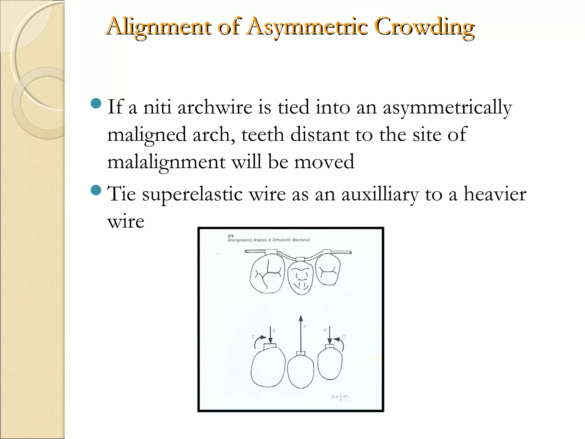 leveling and aligning in orthodontics | PPT