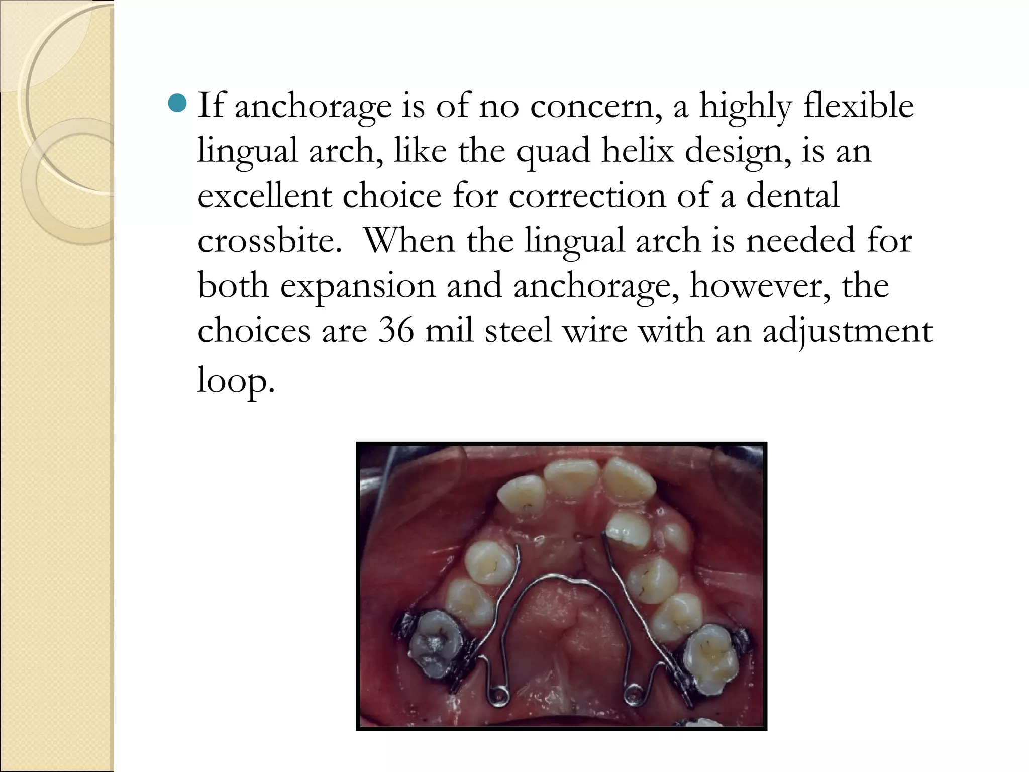 leveling and aligning in orthodontics | PPT