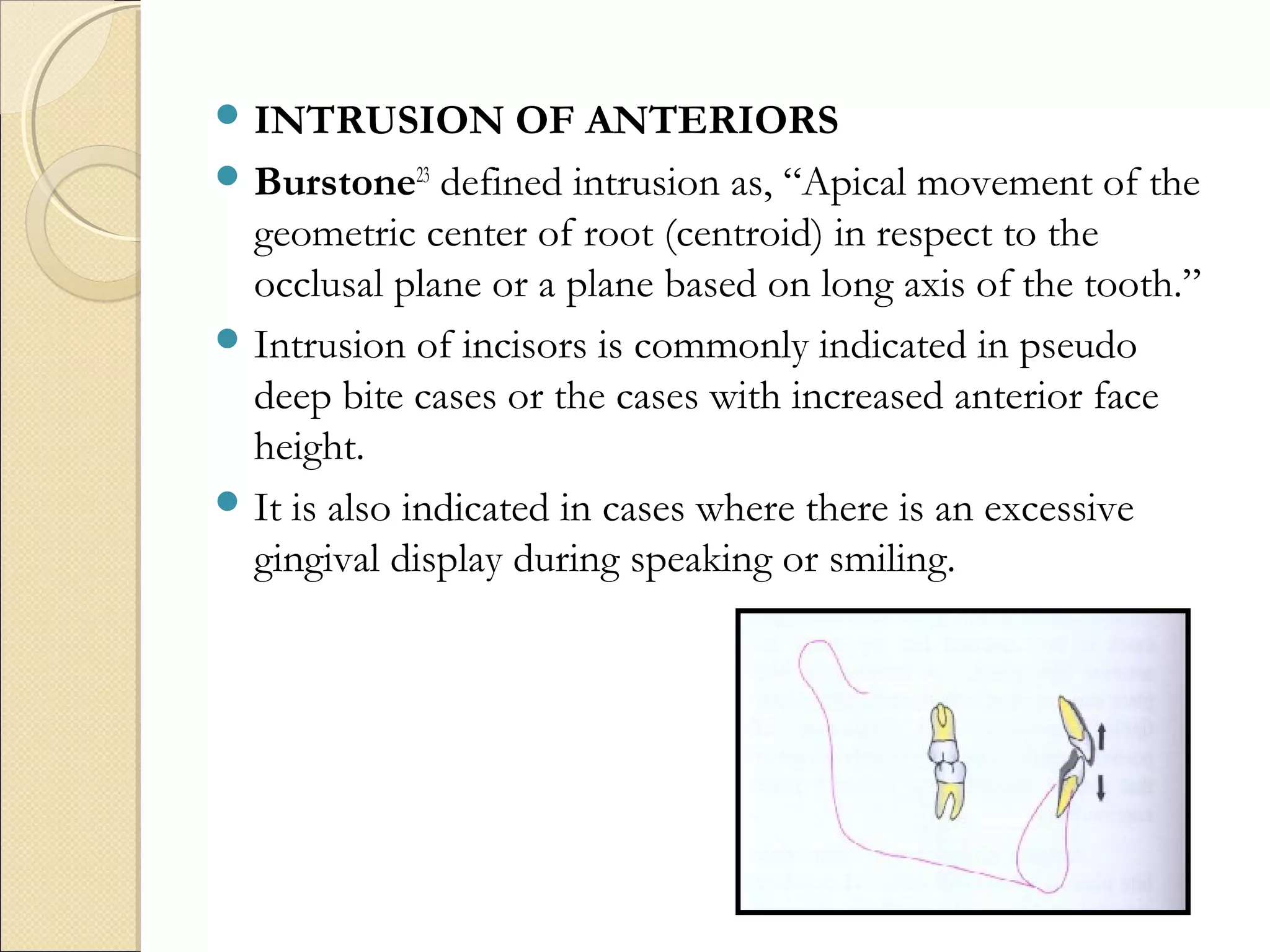leveling and aligning in orthodontics | PPT
