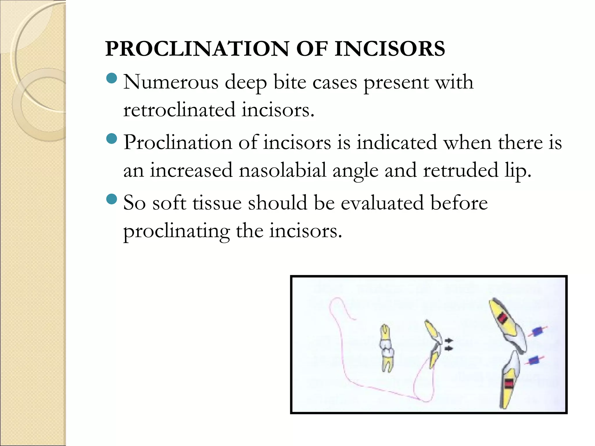 leveling and aligning in orthodontics | PPT