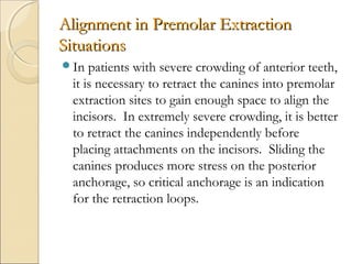 leveling and aligning in orthodontics | PPT
