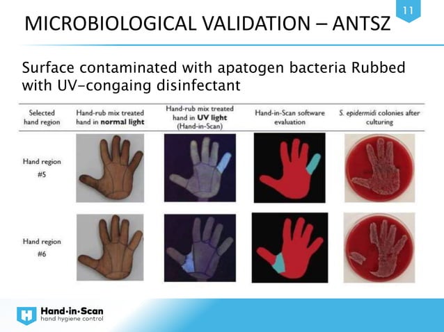 Semmelweis - hand hygiene scanner to prevent HAI infections | PPT