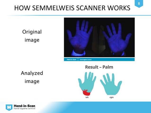 Semmelweis - hand hygiene scanner to prevent HAI infections | PPT
