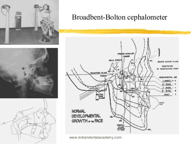 Sem methods of study bone growth /certified fixed orthodontic courses…