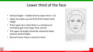 diagnosis and treatment planning for orthognathic surgery | PPTX