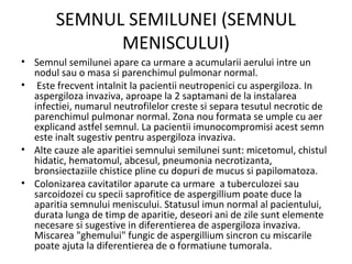 Semne in radiologia toracică | PPT