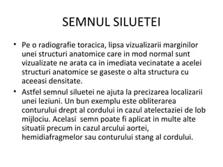 Semne in radiologia toracica2 | PPT