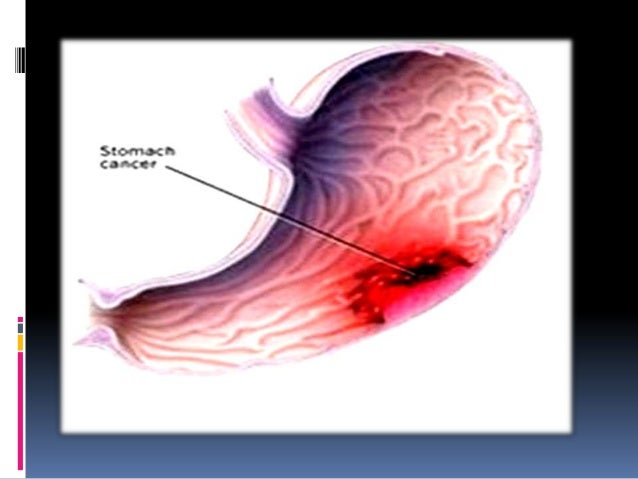 Semundjet e trashegueshme