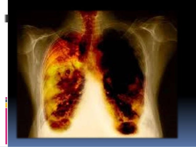 Semundjet e trashegueshme