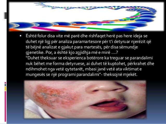 Semundjet e trashegueshme