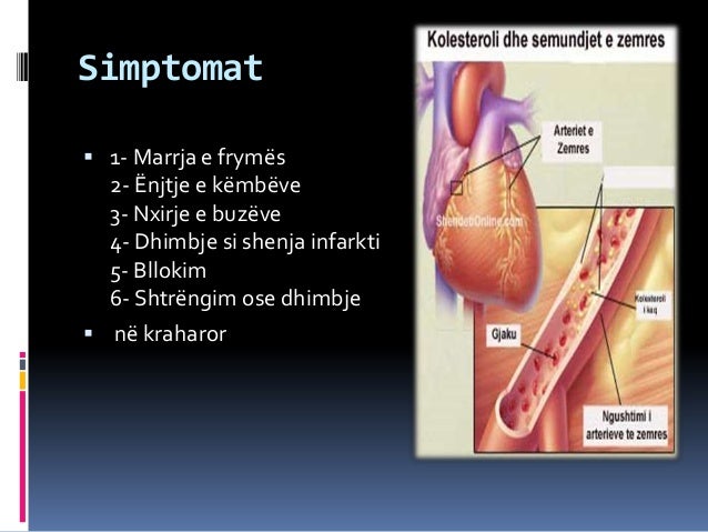 Semundjet e trashegueshme
