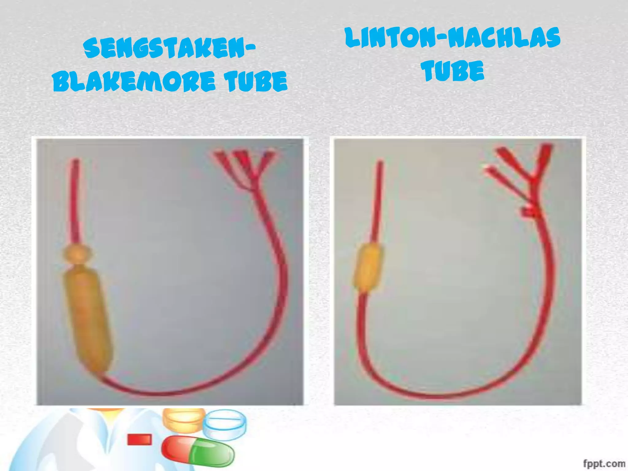Sengstaken blakemore tube | PPTX