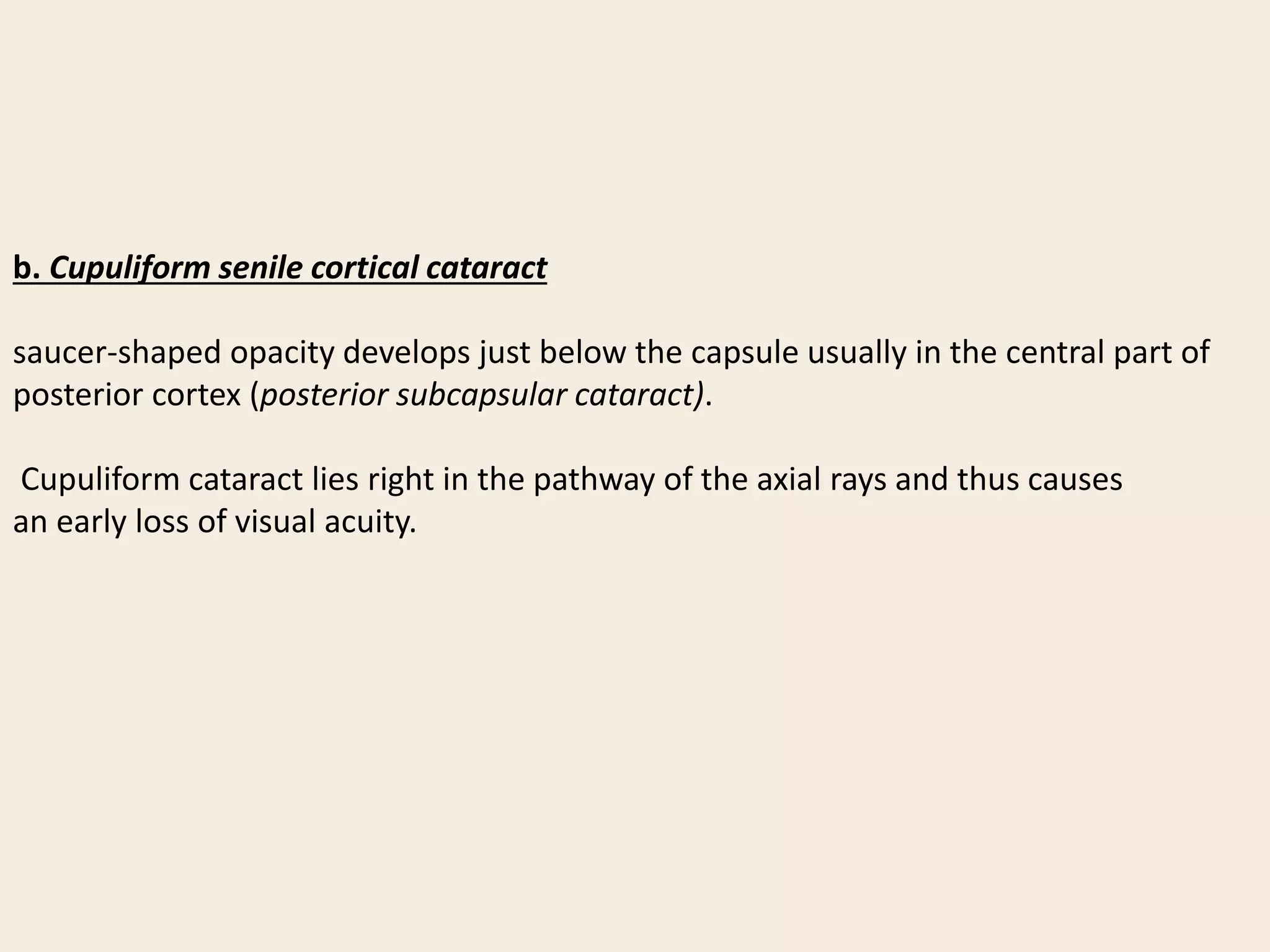 Senile cataract quick revision ( ophthalmology ) | PPTX