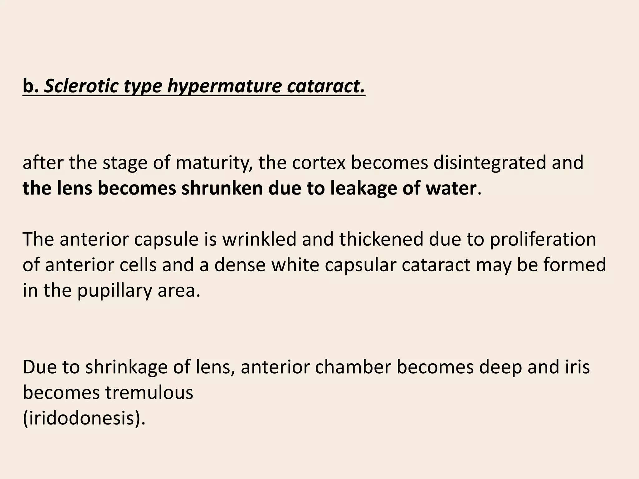 Senile cataract quick revision ( ophthalmology ) | PPTX