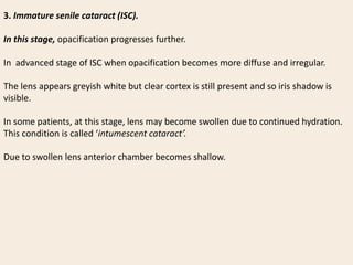 Senile cataract quick revision ( ophthalmology ) | PPTX