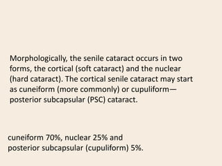 Senile cataract quick revision ( ophthalmology ) | PPTX