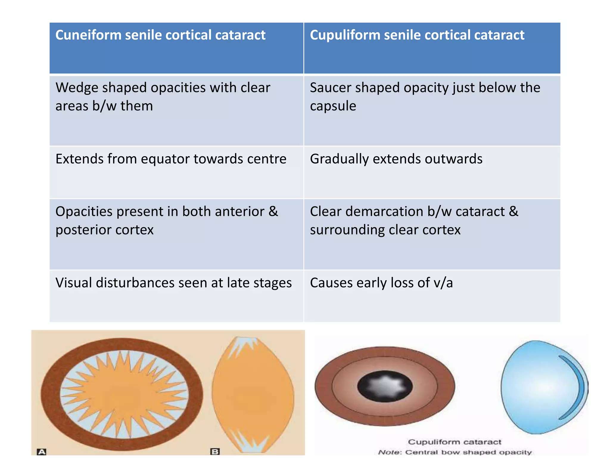 senile cataract.pptx