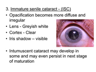 senile cataract.pptx
