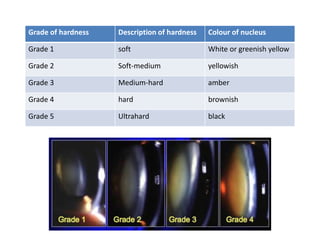 senile cataract.pptx